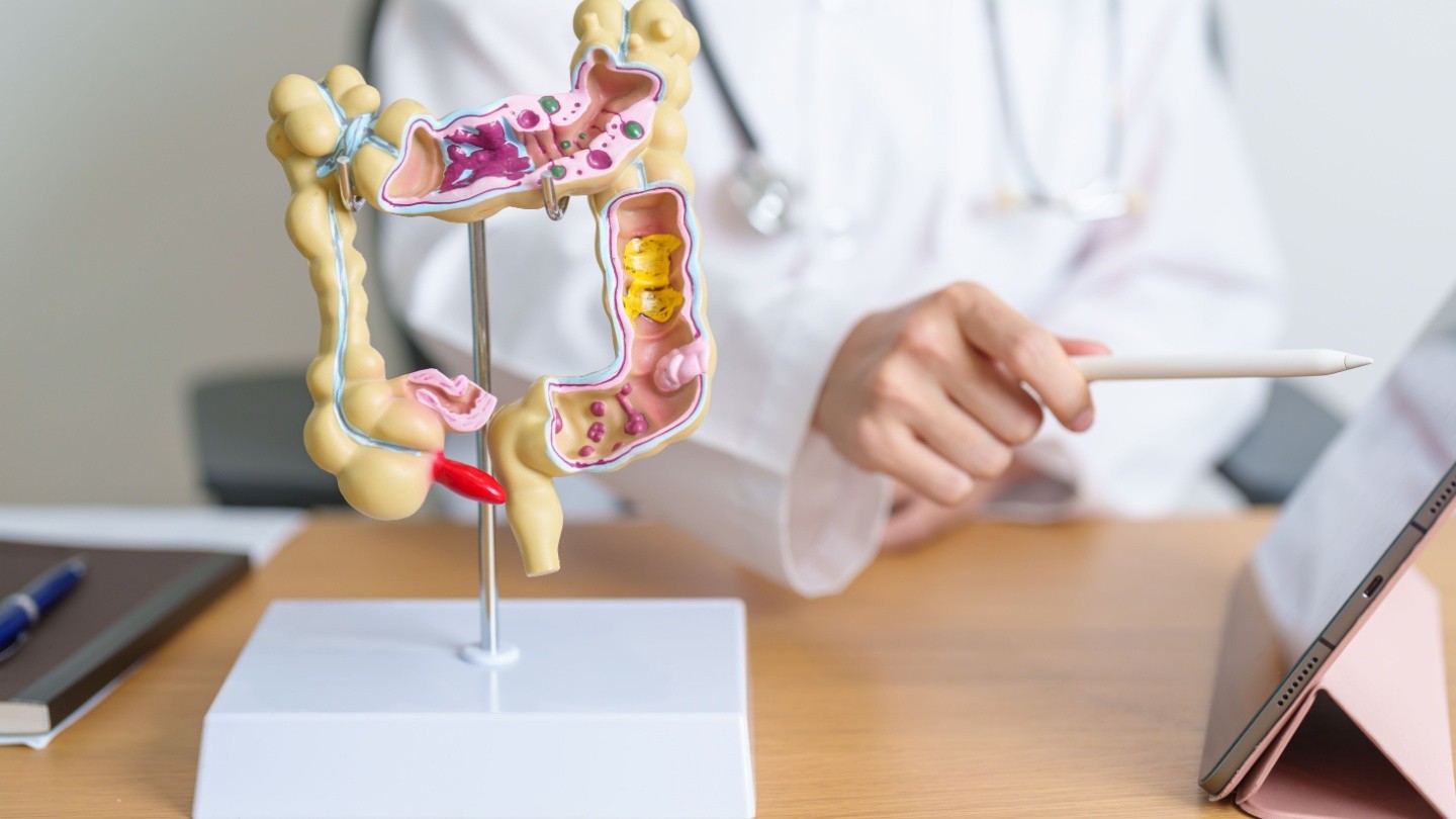 Mainz Biomed partners with Quest for colorectal cancer screening te...